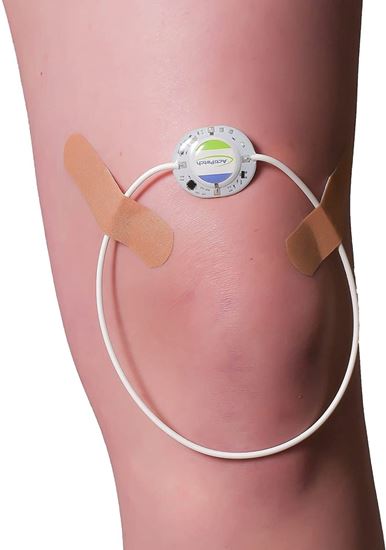 ActiPatch Knee Pain Therapy Device.Ultior Ltd