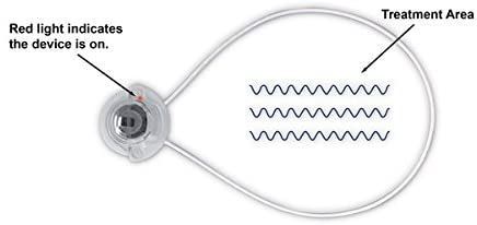 ActiPatch Knee Pain Therapy Device.Ultior Ltd